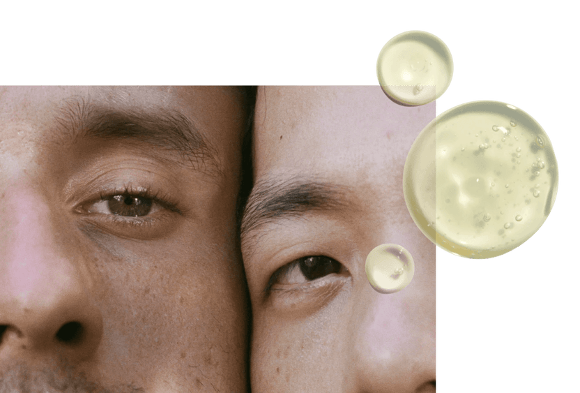 The Hyperpigmentation Solution