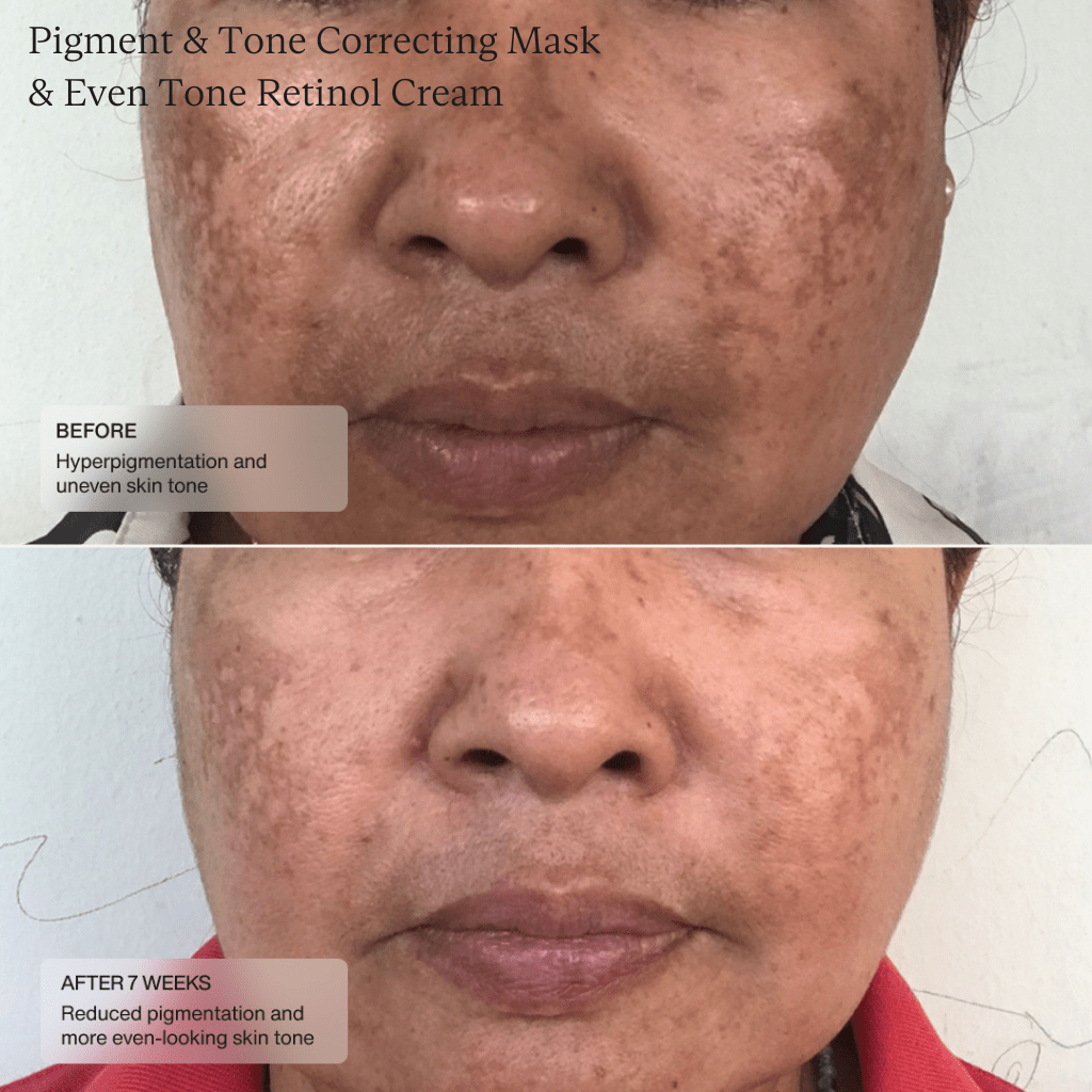 Pigment & Tone Correcting Mask