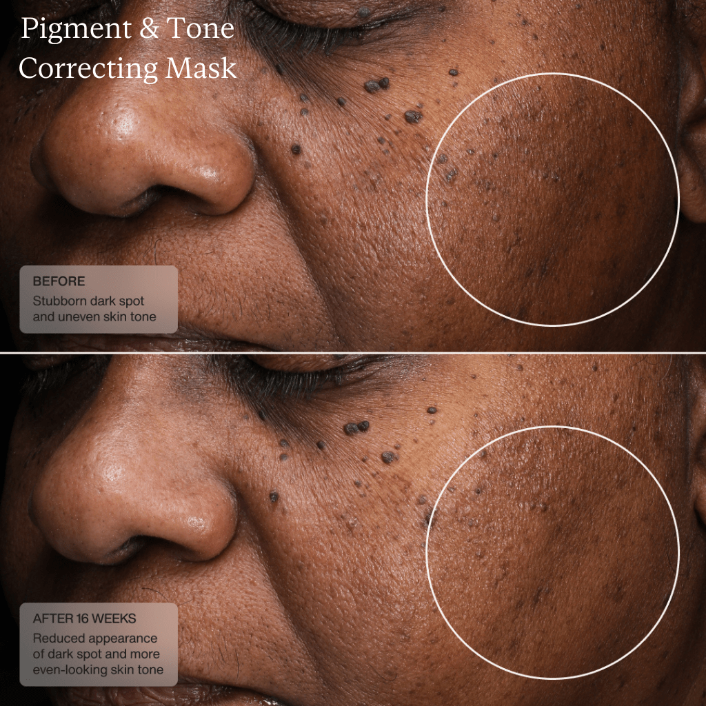 Pigment & Tone Correcting Mask