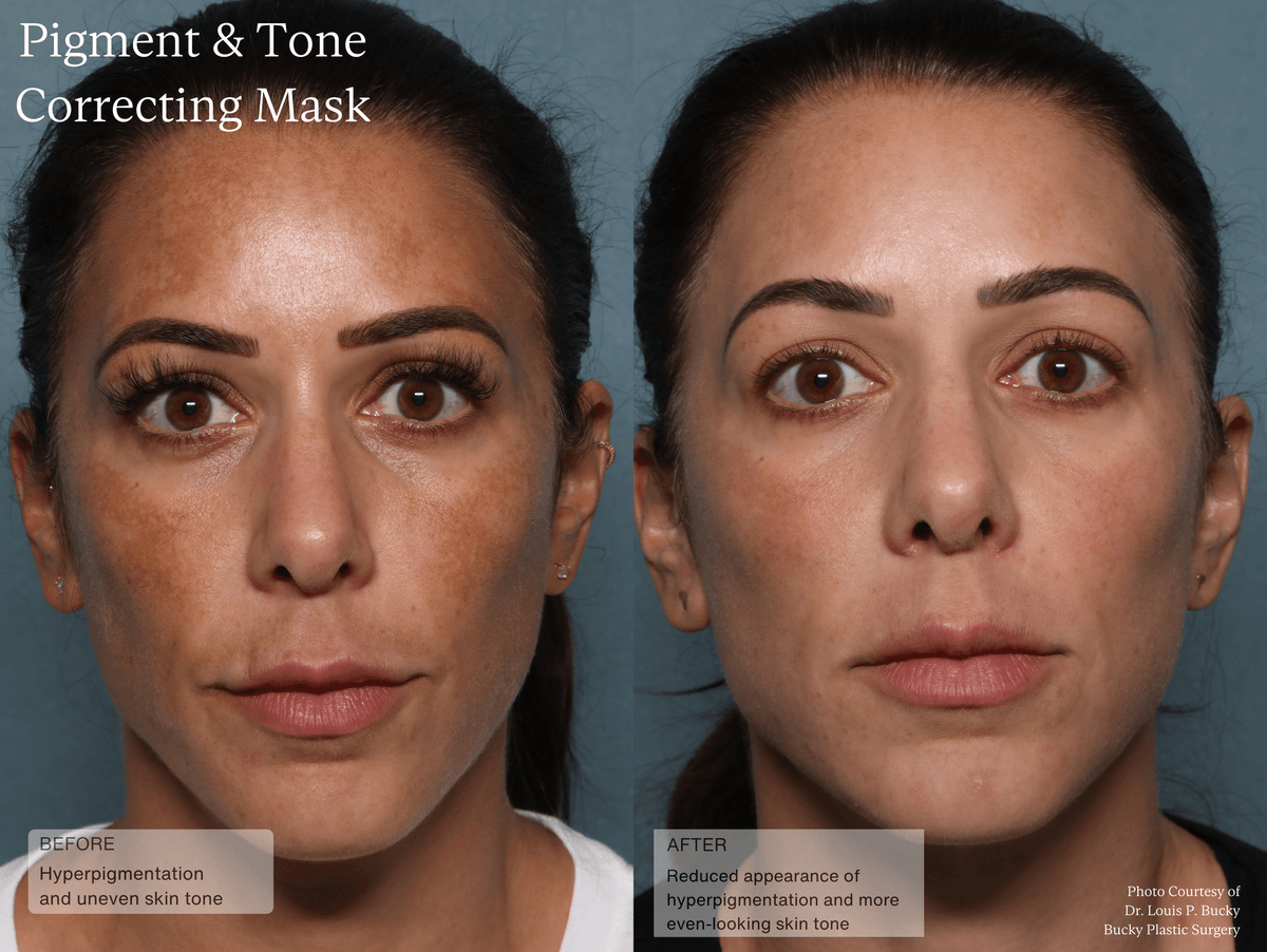 Pigment & Tone Correcting Mask
