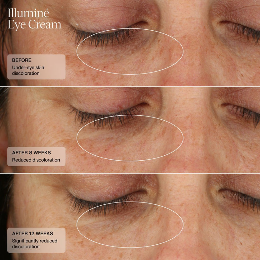 Illuminating Eye Cream | Rejuvenate Your Eye Area | Senté